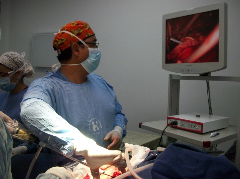 VATS decortication: Empyema – Thoracic Surgery