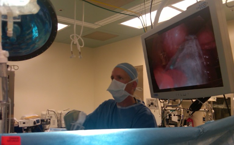 bleb resection – Thoracic Surgery